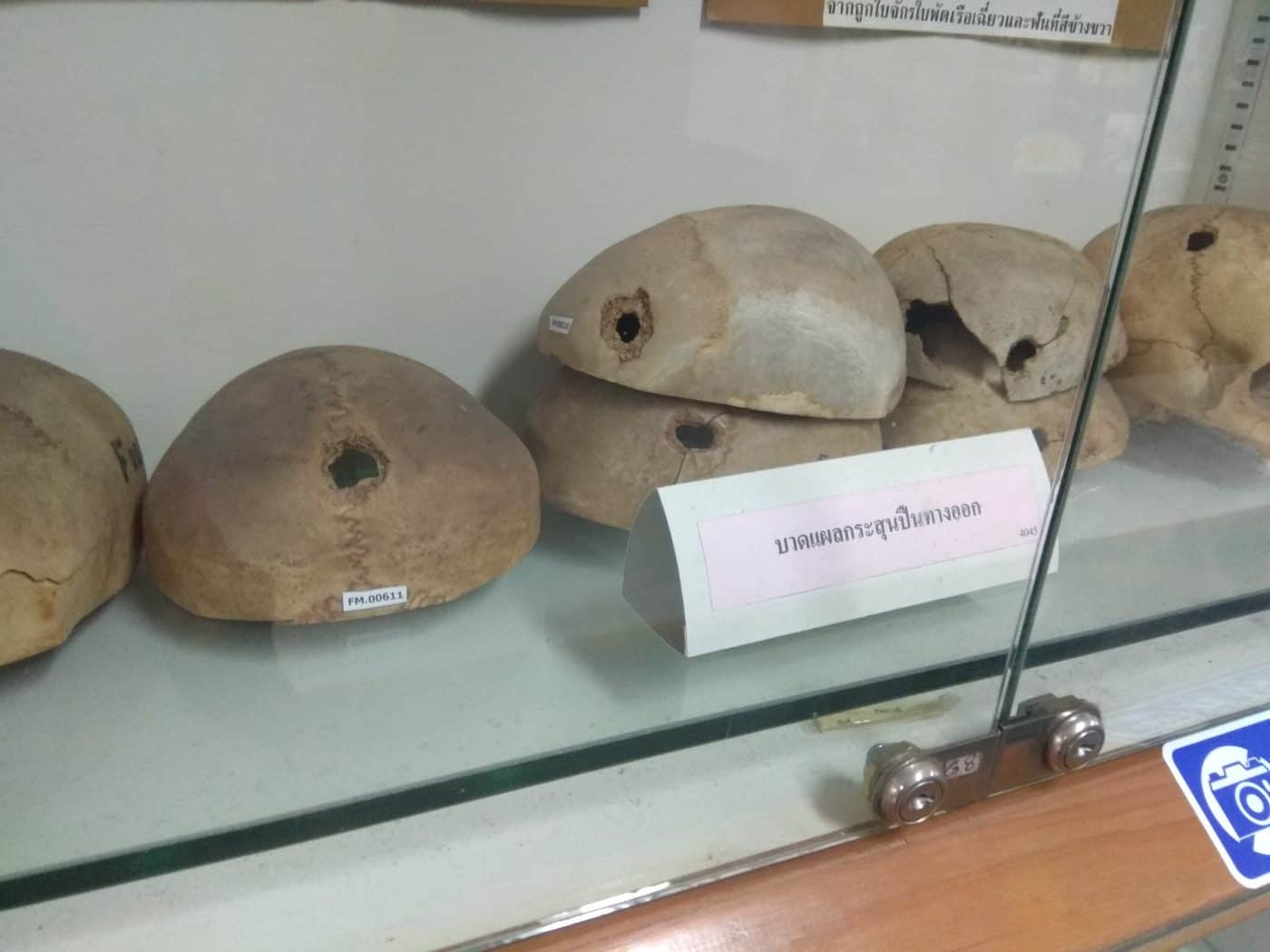 Death Museum Bangkok (Siriraj Medical Museum) – Not For The Faint ...